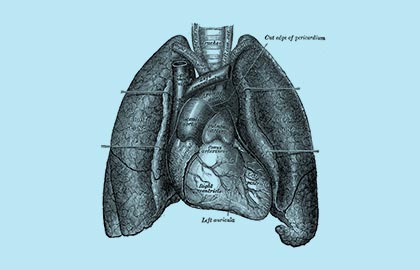 Minimally Invasive Aortic Root Replacement (mini-Bentall) - Sydney ...